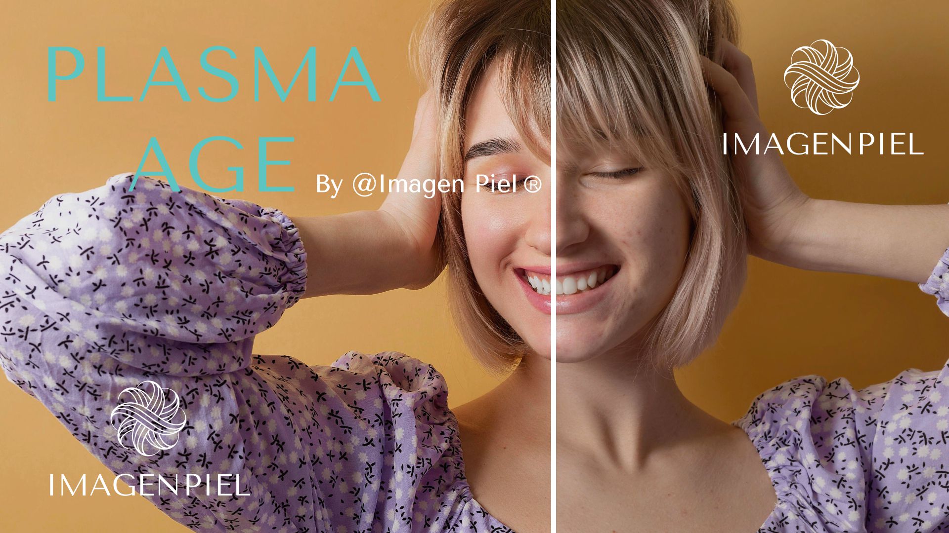 Imagen Piel - Rejuvenece tu vida con Plasma Age